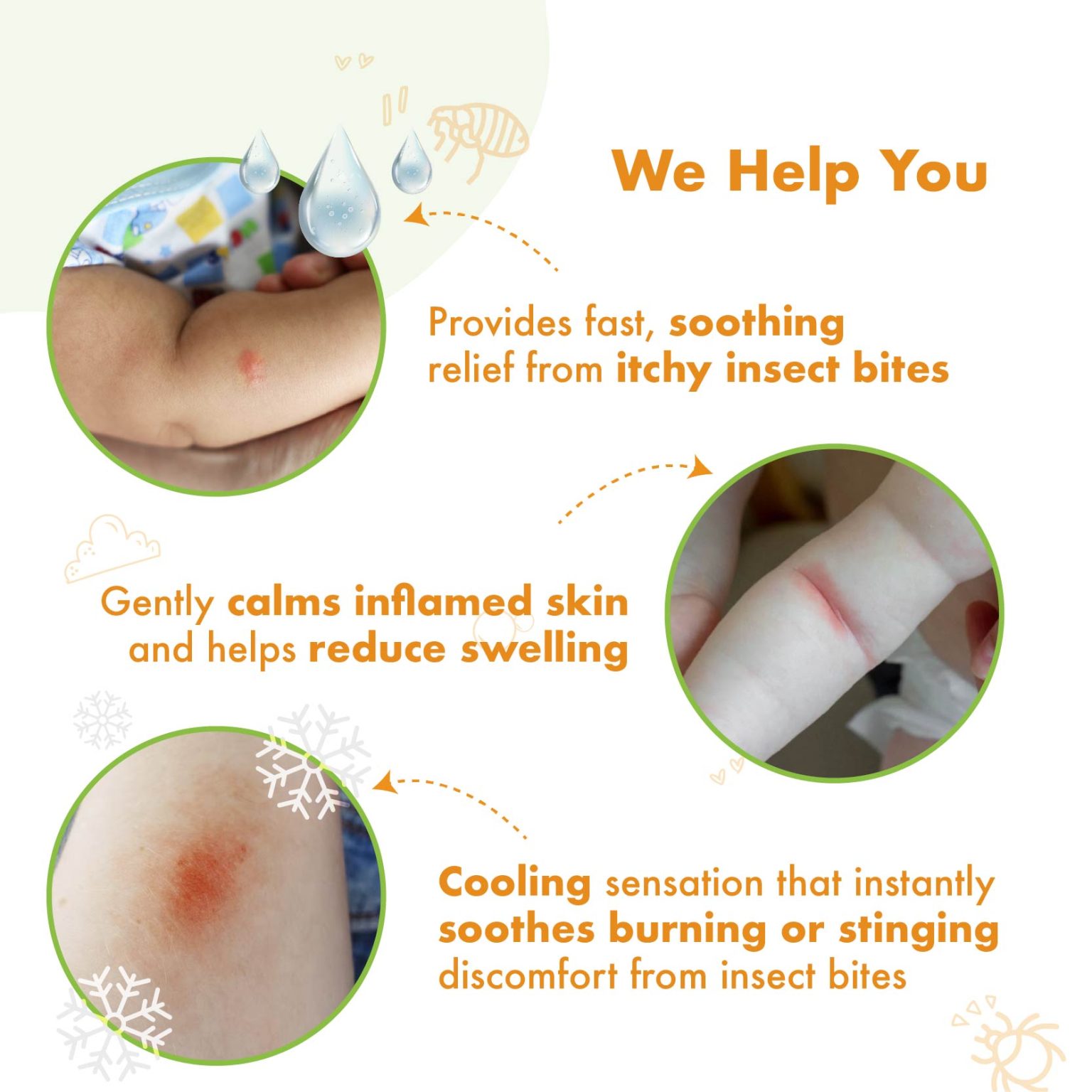Mosquito & Insect Bite Relief Cream 20ml – BerryC